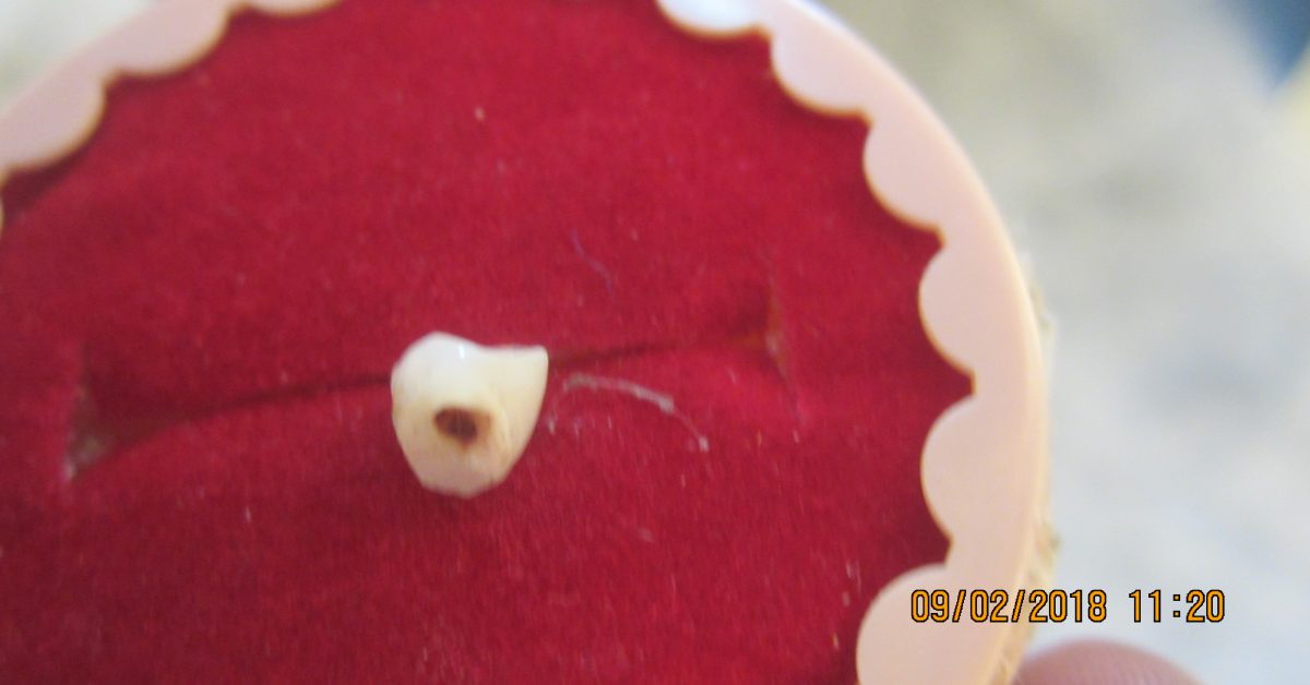 Observing teeth – SmallScience